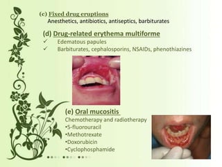 Oral manifestations of drug reactions & treatment | PPTX