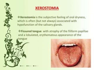 Oral manifestations of drug reactions & treatment | PPTX