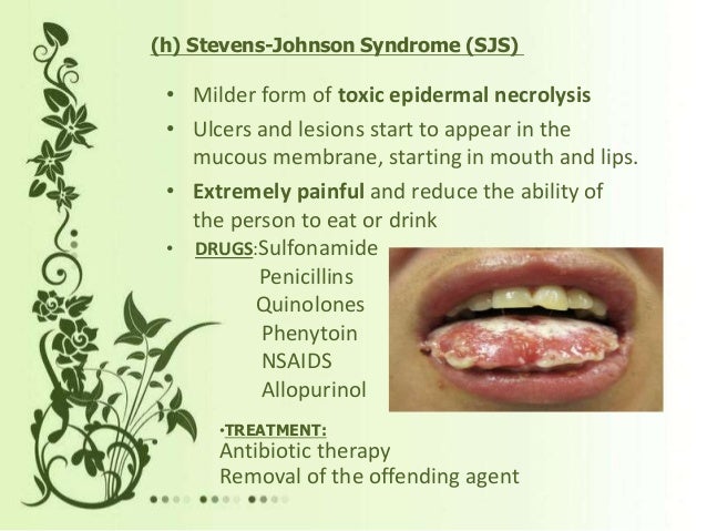 Oral manifestations of drug reactions & treatment