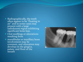 Oral manifestations in systemic diseases | PPTX