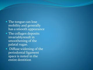Oral manifestations in systemic diseases | PPTX