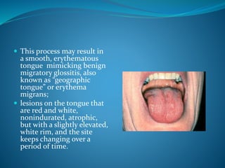 Oral manifestations in systemic diseases | PPTX