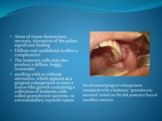 Oral manifestations in systemic diseases | PPTX