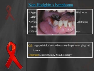Oral manifestations of AIDS - ACQUIRED IMMUNO DEFICIENCY SYNDROME [ HIV ...