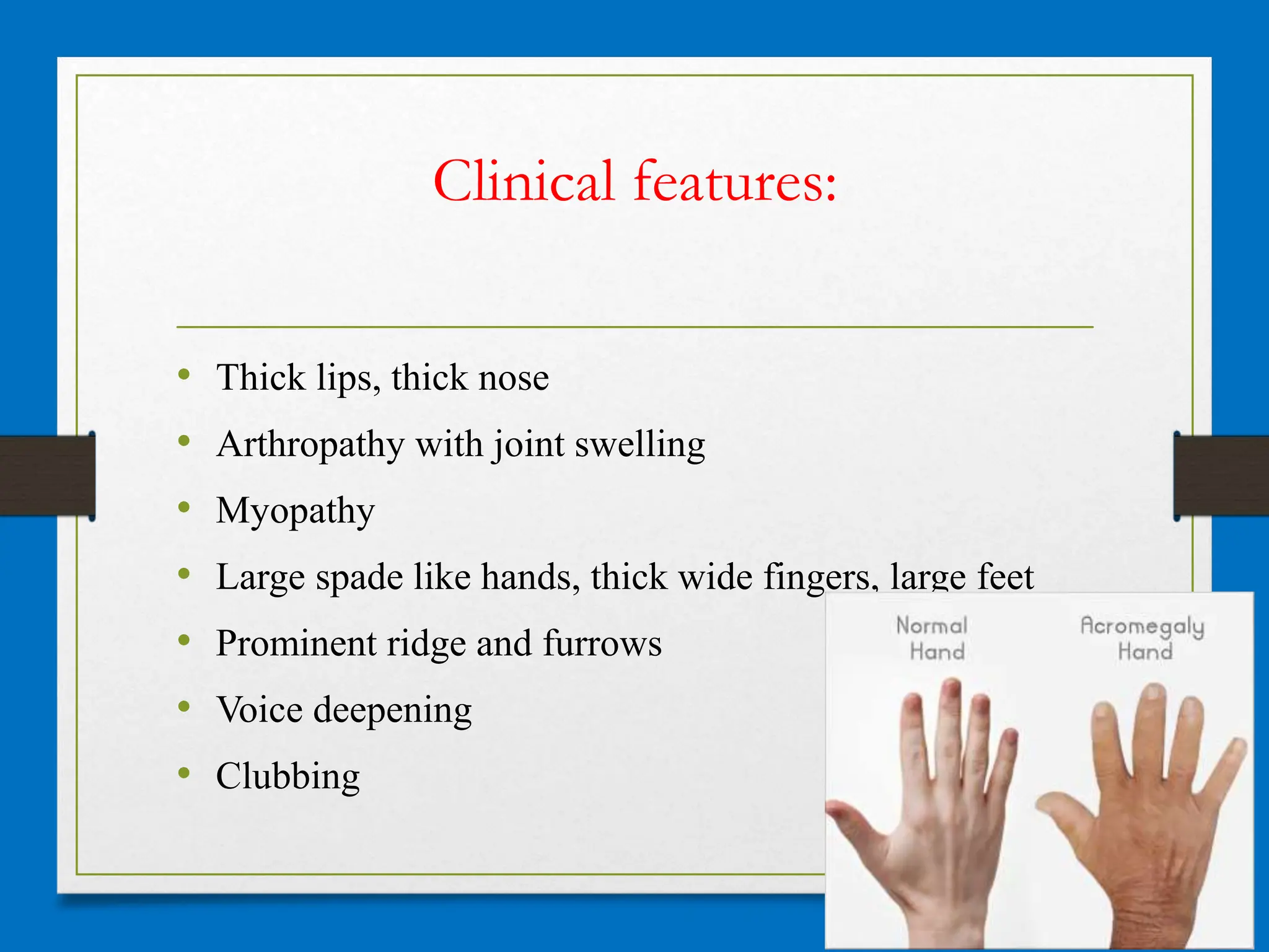 ORAL MANIFESTATIONS OF ENDOCRINE DISORDERS.ppt