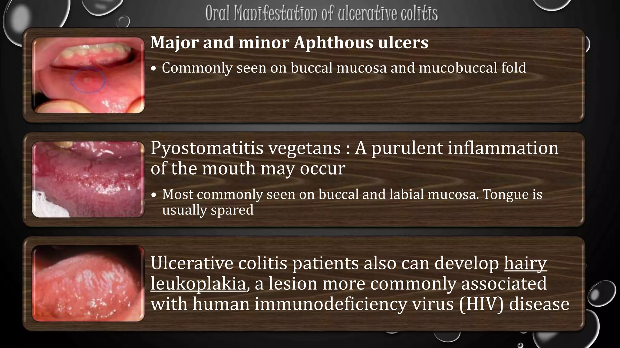 Oral manifestations of gastrointestinal disorders.ppt