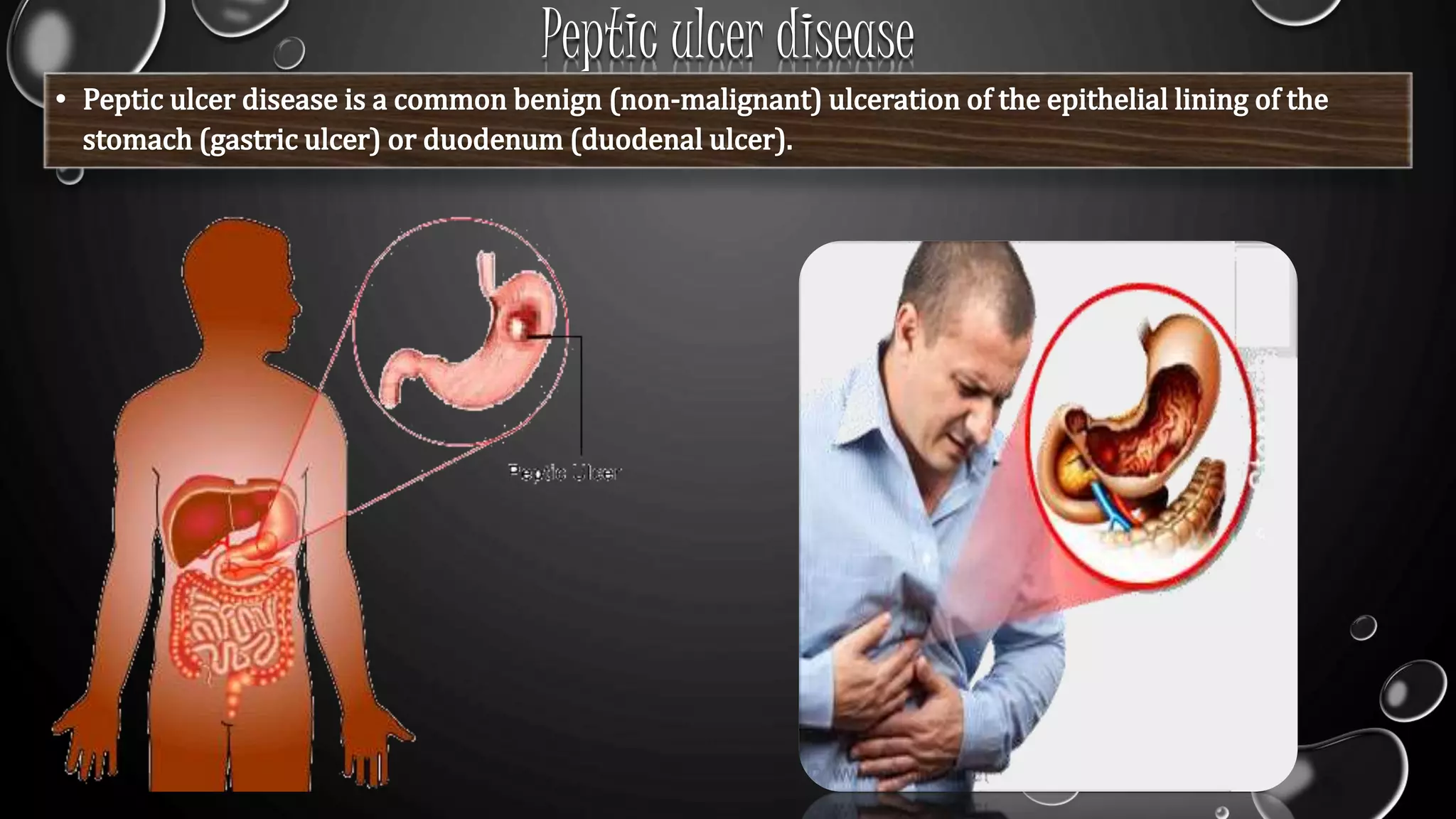 Oral manifestations of gastrointestinal disorders.ppt