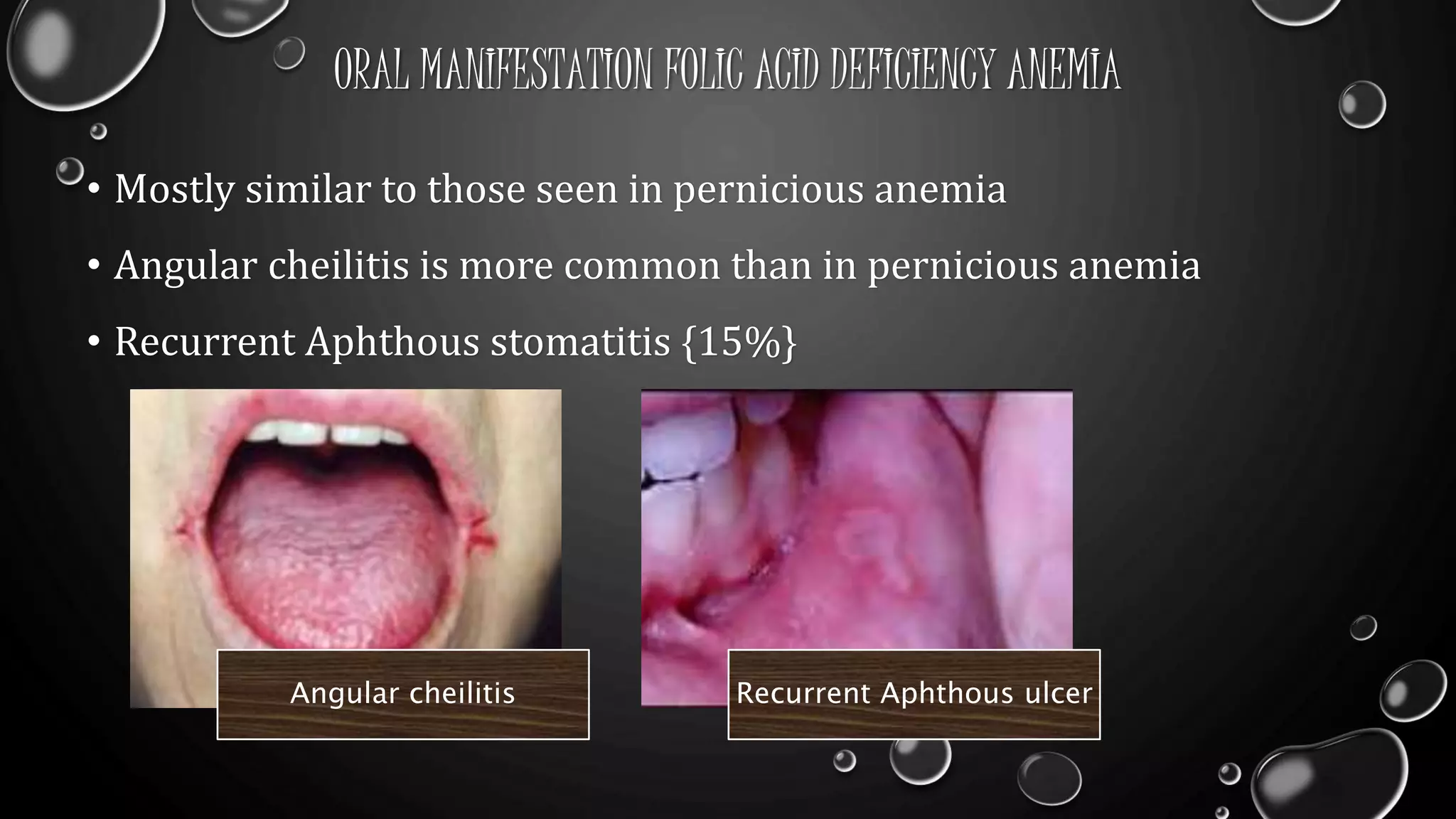 Oral manifestations of gastrointestinal disorders.ppt