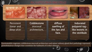 Oral manifestations of gastrointestinal disorders.ppt