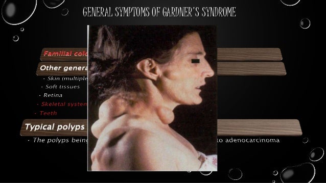 Oral manifestations of gastrointestinal disorders.ppt