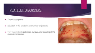 Oral Purpura