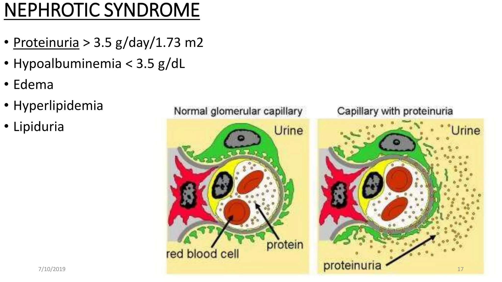 Oral manifestations of renal diseases | PPTX