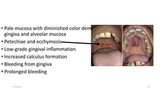 Oral manifestations of renal diseases | PPTX