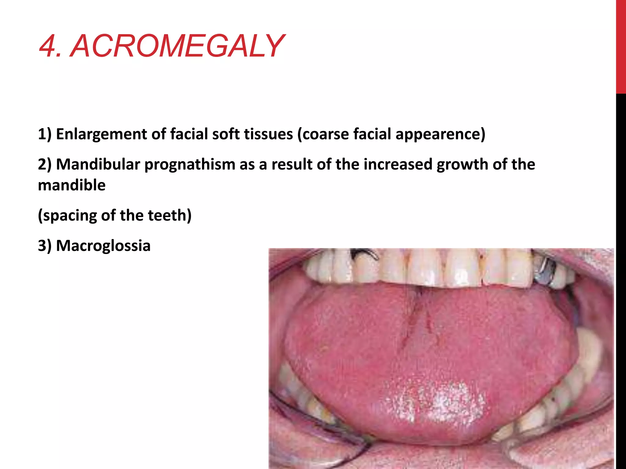 Oral manifestations of systemic disease | PPTX