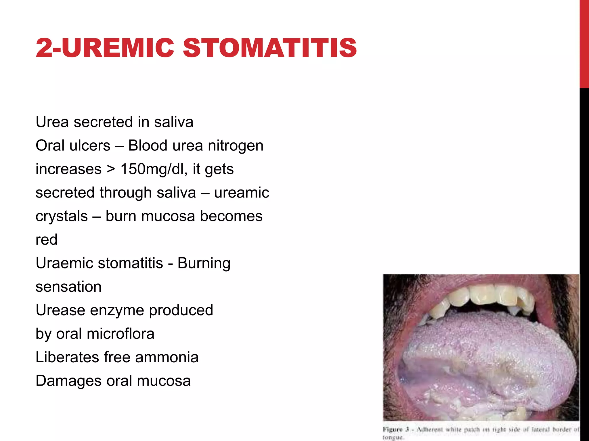 Oral manifestations of systemic disease | PPTX