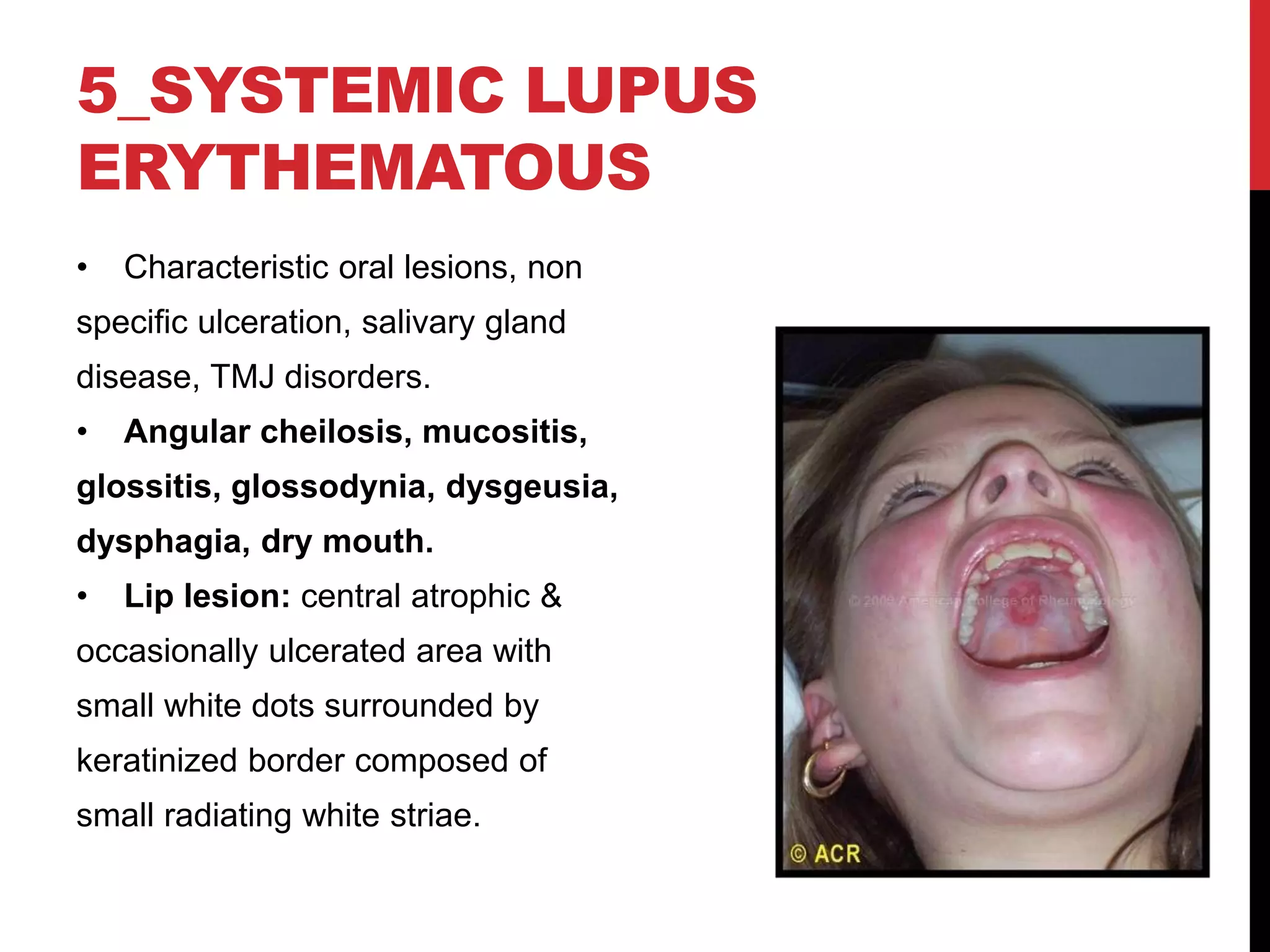 Oral manifestations of systemic disease | PPTX