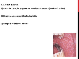 Oral manifestations of systemic disease | PPTX