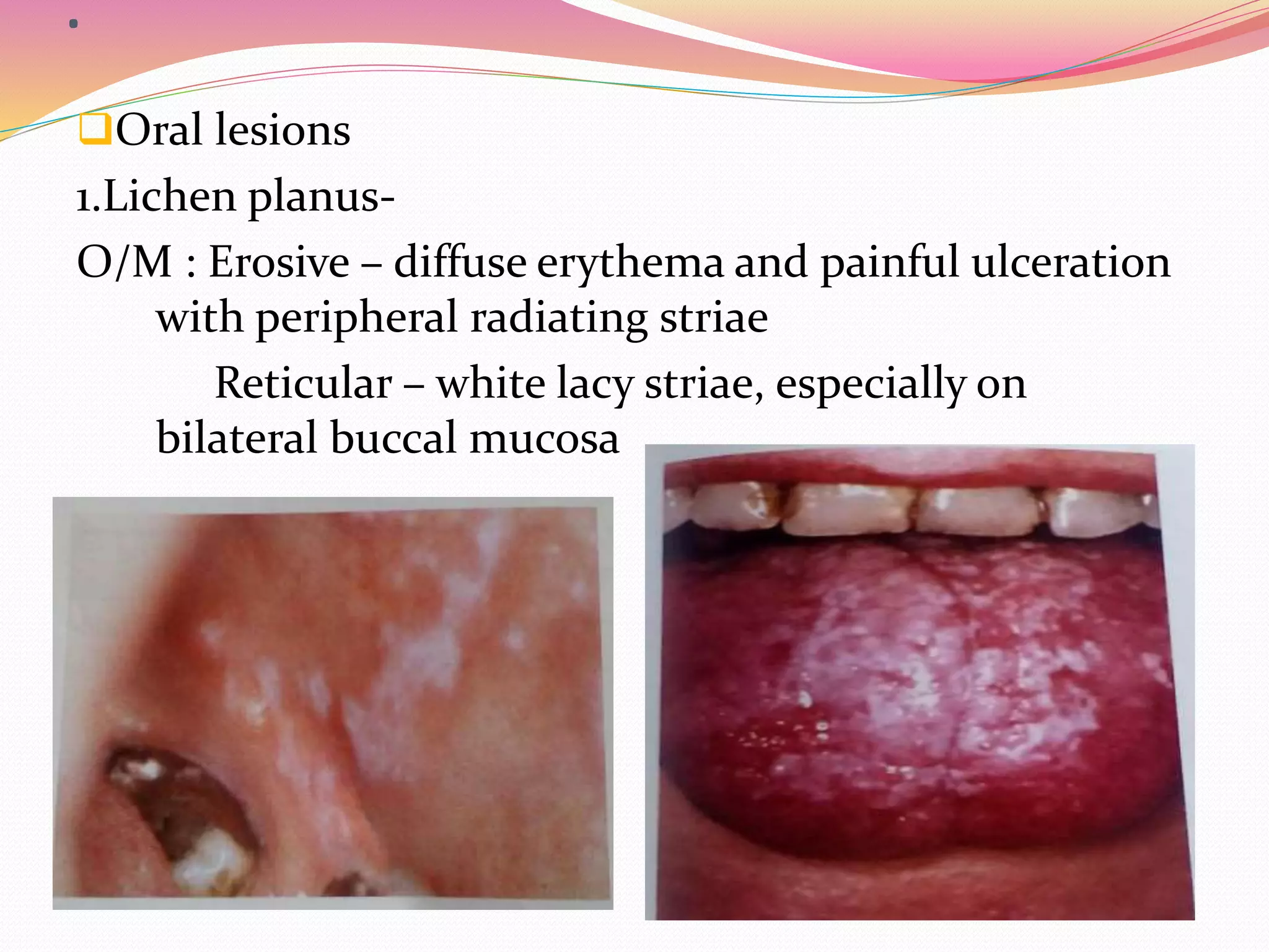 Oral manifestations of systemic diseases | PPTX