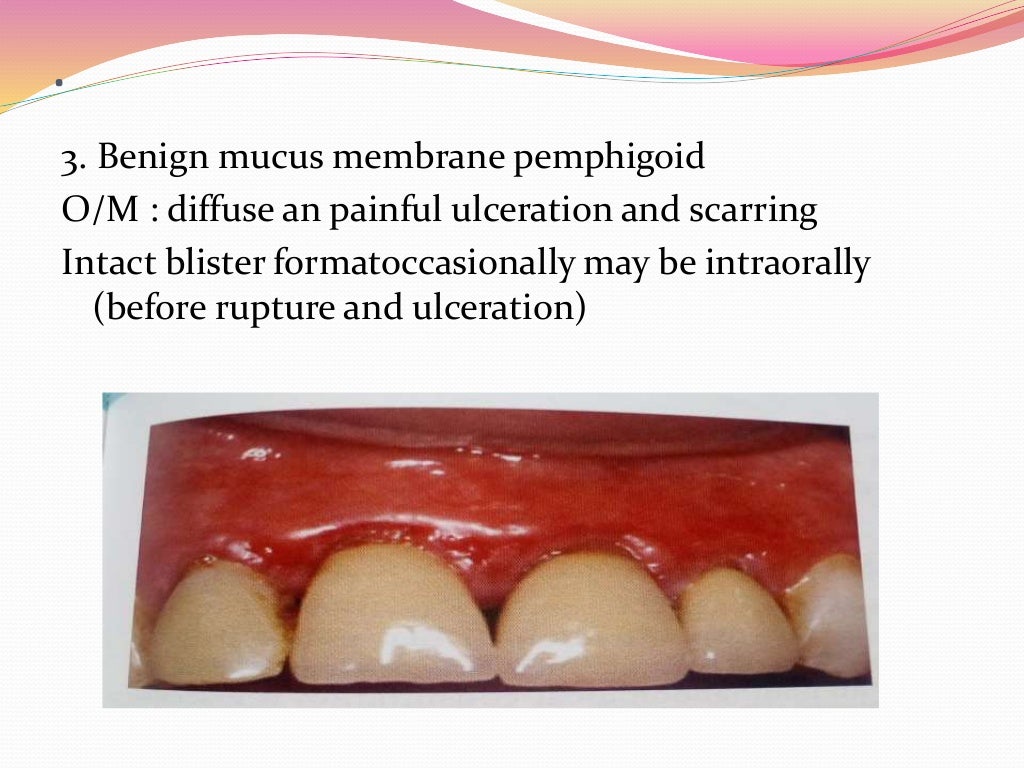 Oral Manifestations Of Systemic Diseases