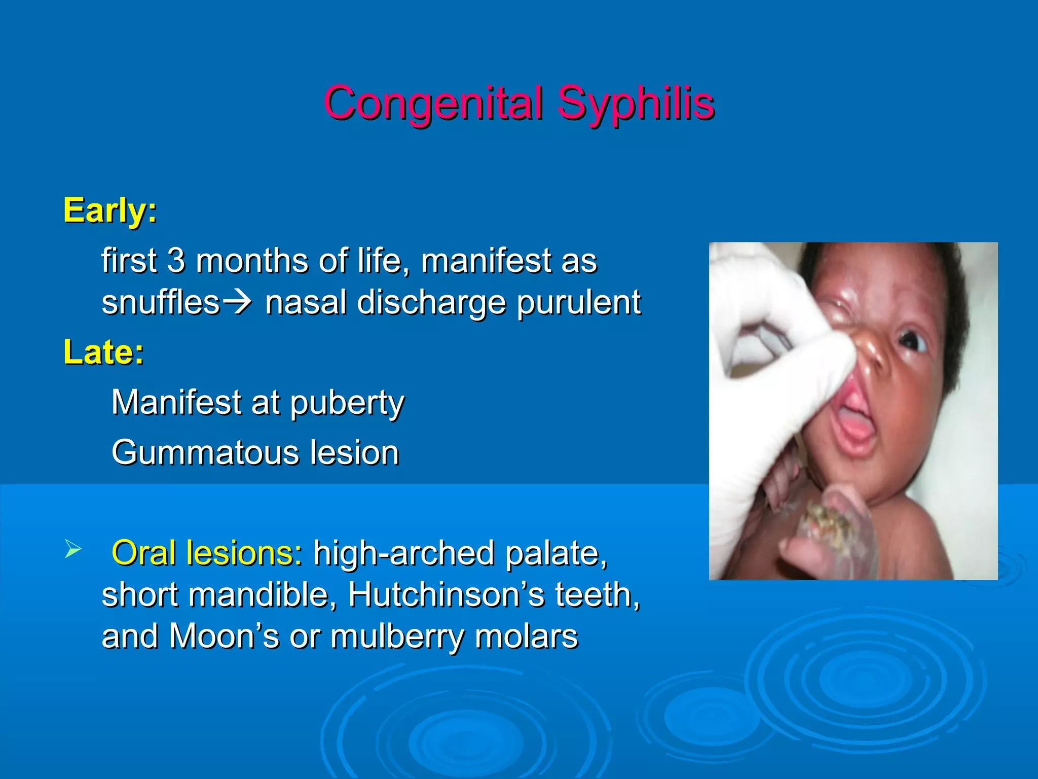Oral manifestations of systemic diseases | PPT
