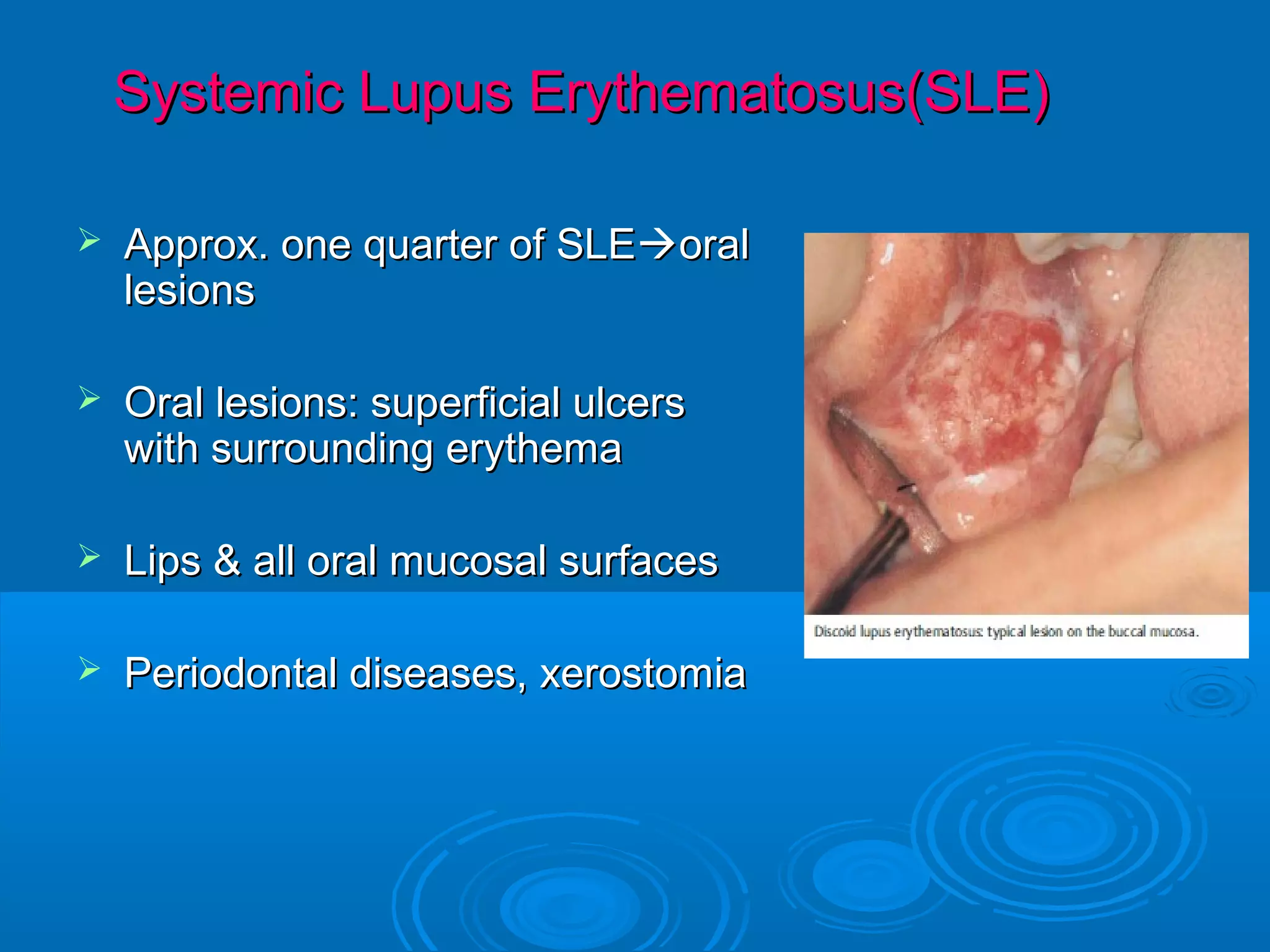 Oral manifestations of systemic diseases | PPT