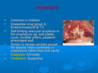 Oral manifestations of systemic diseases | PPT