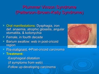Plummer Vinson Syndrome Tongue