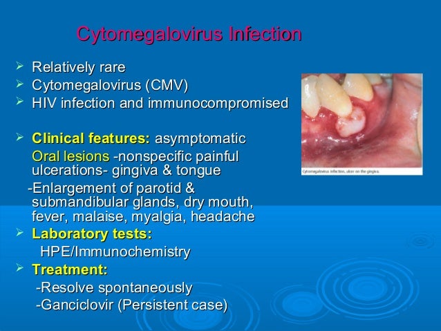 Oral Manifestations Of Systemic Diseases