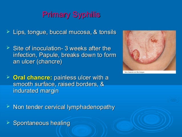Oral manifestations of systemic diseases
