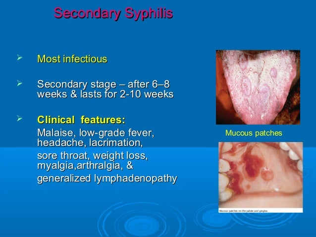 Oral manifestations of systemic diseases