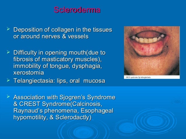 Oral manifestations of systemic diseases