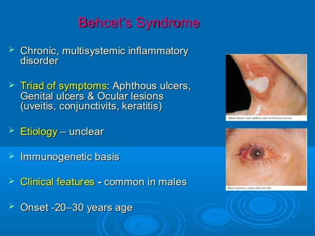 Oral manifestations of systemic diseases