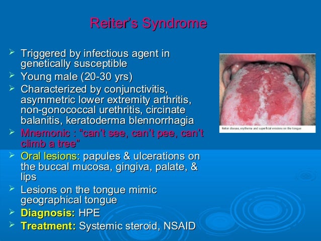 Oral manifestations of systemic diseases