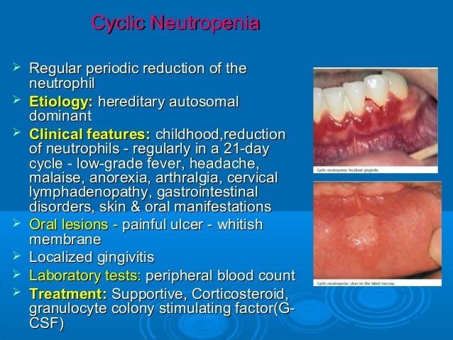 Oral manifestations of systemic diseases