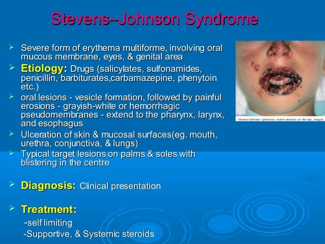 Oral manifestations of systemic diseases