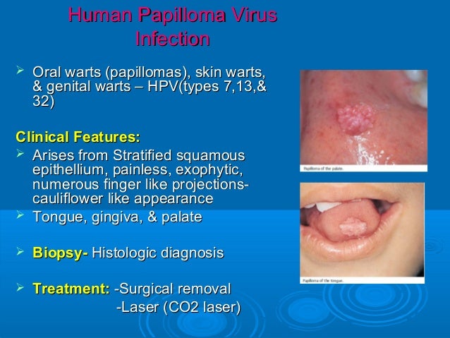 Oral manifestations of systemic diseases