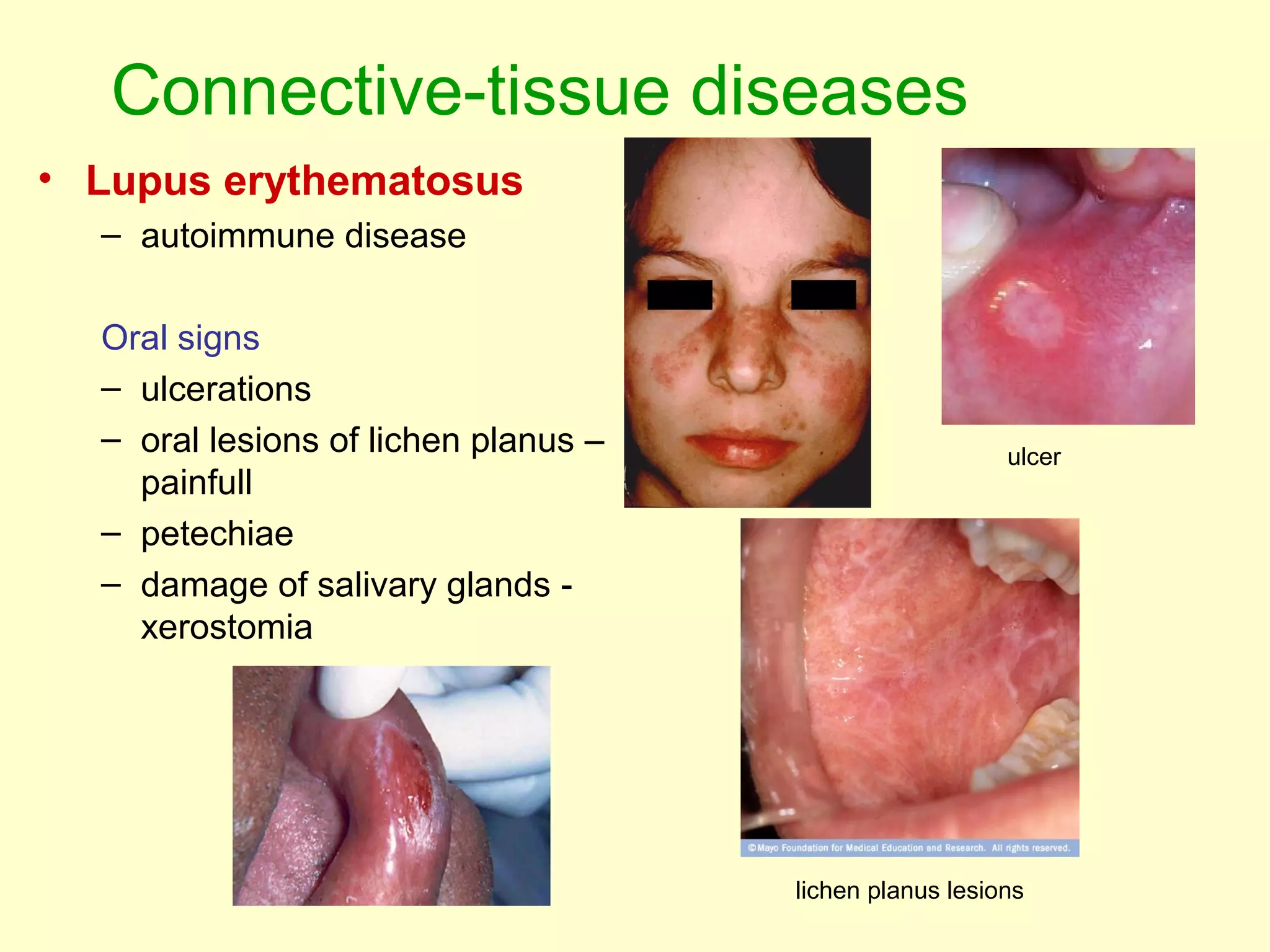 Oral manifestations of systemic diseases | PPT