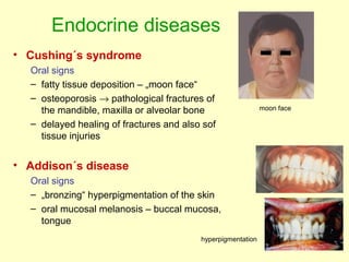 Oral manifestations of systemic diseases | PPT