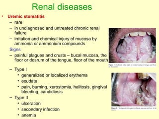 Types Of Oral Diseases