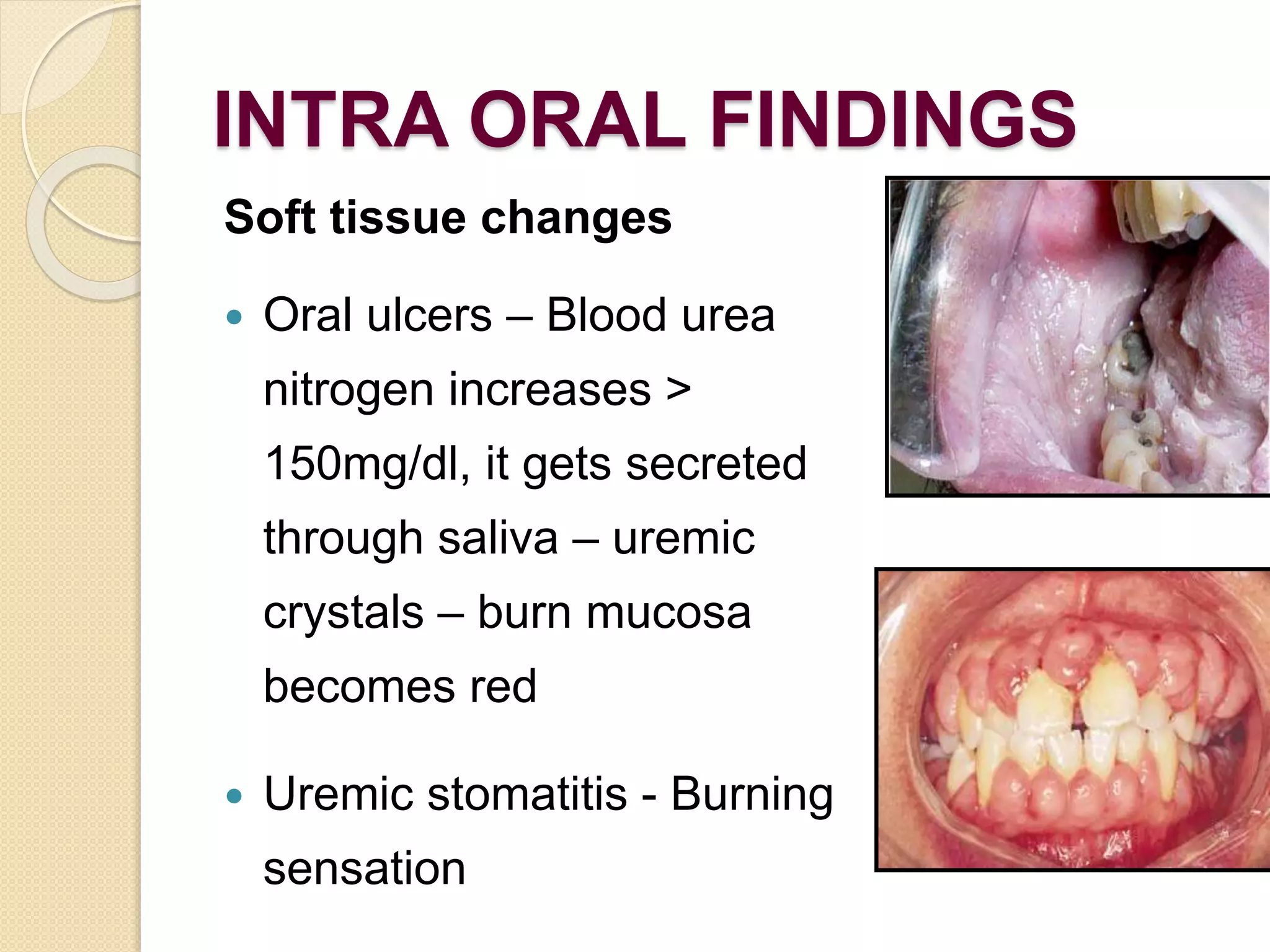 Oral manifestations of systemic diseases | PPTX
