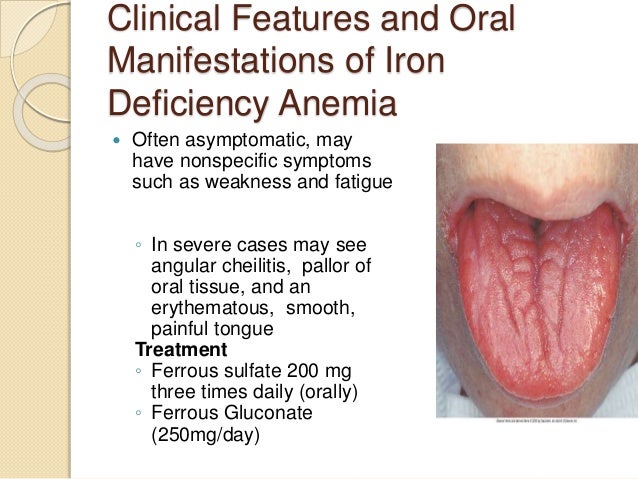 Oral Manifestations Of Systemic Diseases