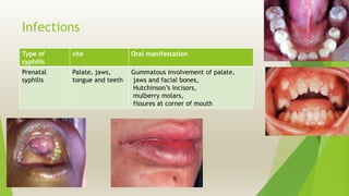 ORAL MANIFESTATIONS OF SYSTEMIC DISEASES.pptx