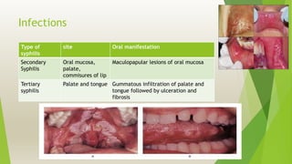 ORAL MANIFESTATIONS OF SYSTEMIC DISEASES.pptx