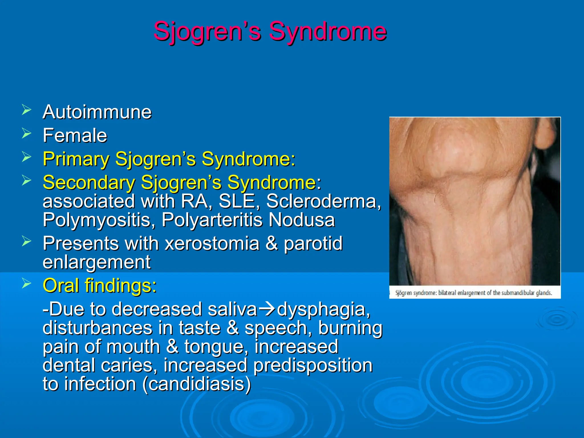 Oral Manifestations of systemic diseases.pdf