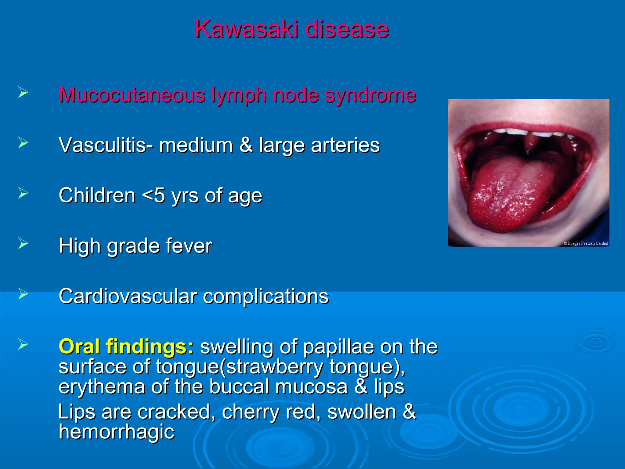 Oral Manifestations Of Systemic Diseases Pdf