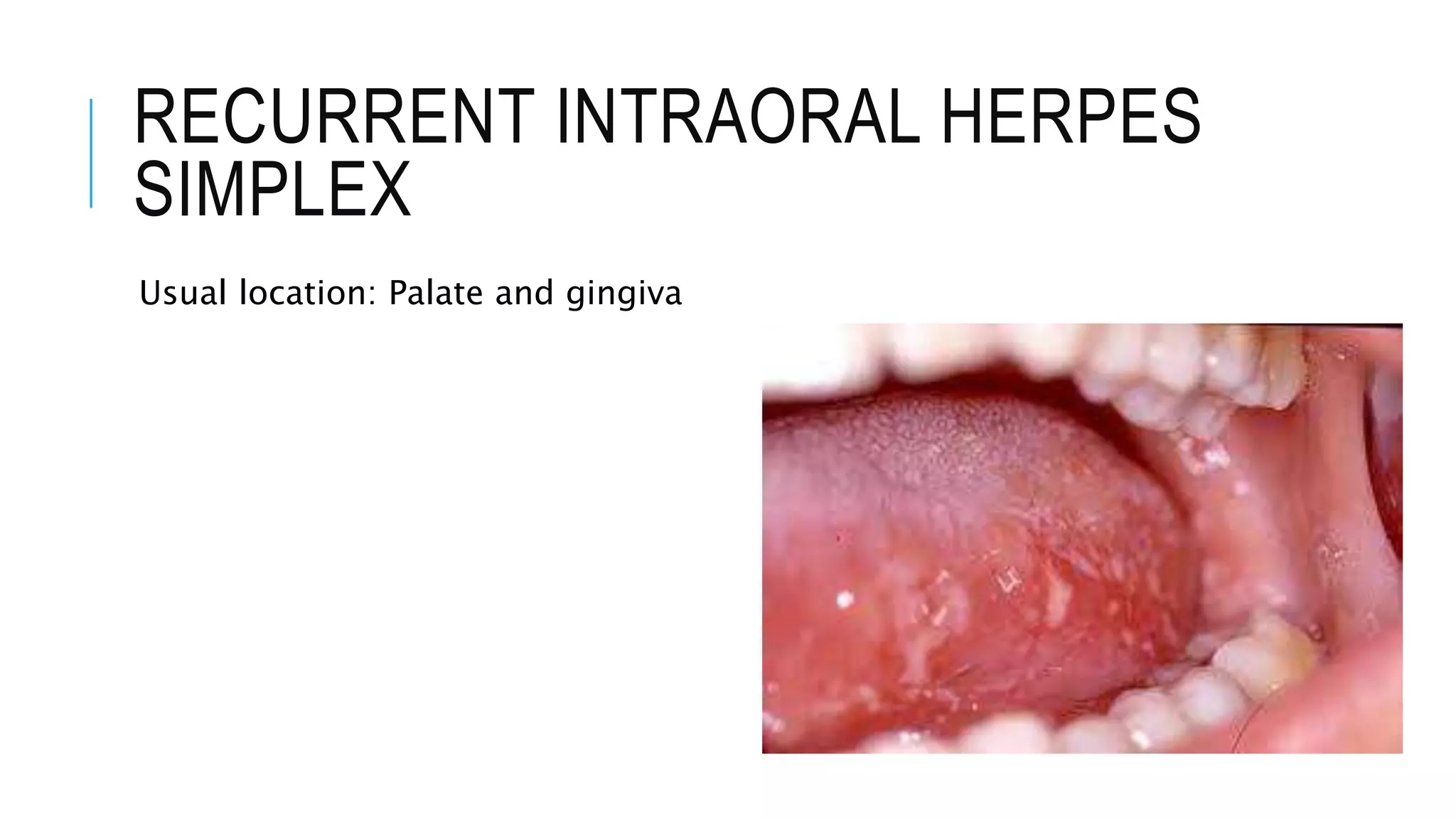 ORAL MANIFESTATIONS OF SYSTEMIC MEDICAL DISORDER.pptx