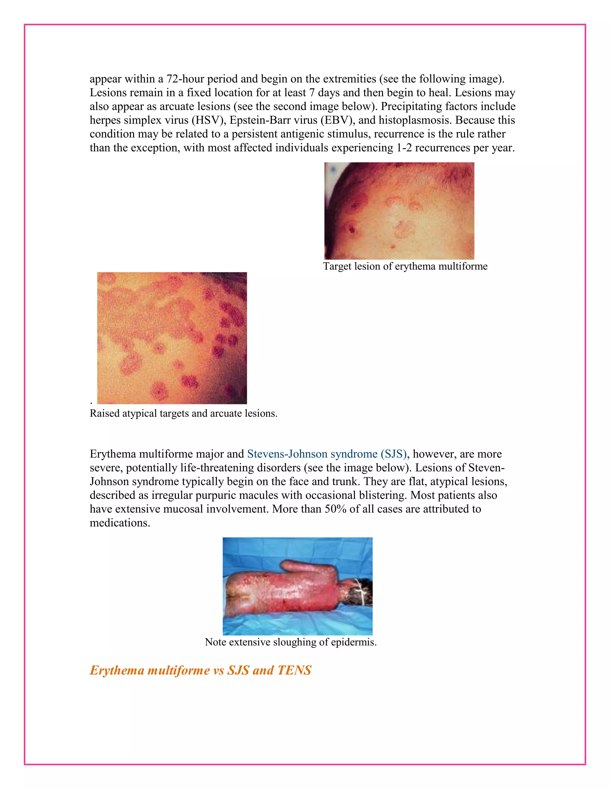 Muco-cutaneo-ocular syndrome | PDF