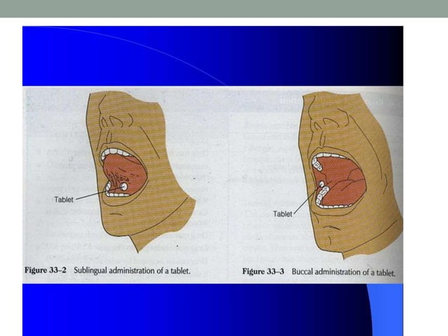 Oral medications Procedures of Administering Oral Medicines | PPTX