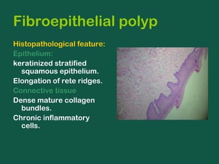 Oral medicine case(fibro-epithelial polyp) | PPT