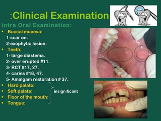 Oral medicine case(fibro-epithelial polyp) | PPT